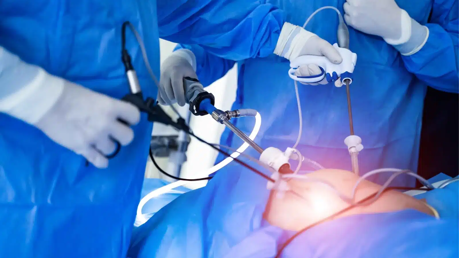 Laparoscopic Hysterectomy | Sahaj Hospital