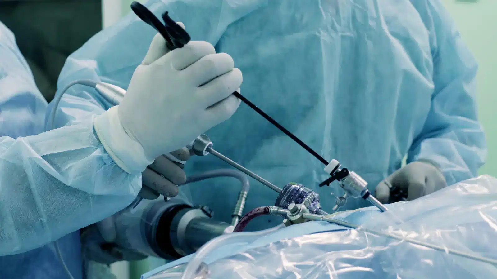 Laparoscopic Myomectomy | Sahaj Hospital